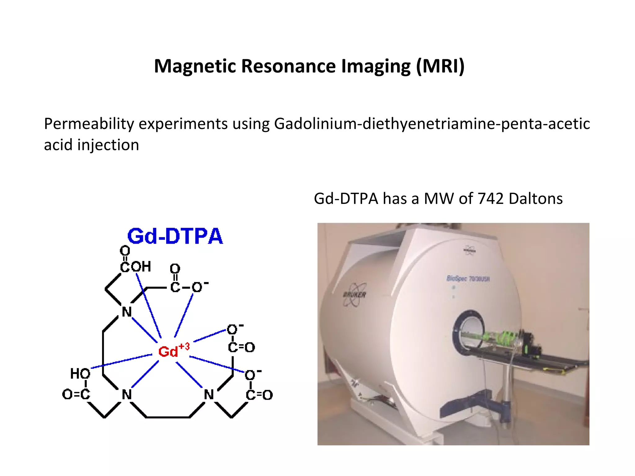 Dr Matthew Campbell - AGM 2011 - AMD Drug Delivery | PPT