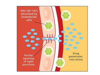 Dr Matthew Campbell - AGM 2011 - AMD Drug Delivery | PPT