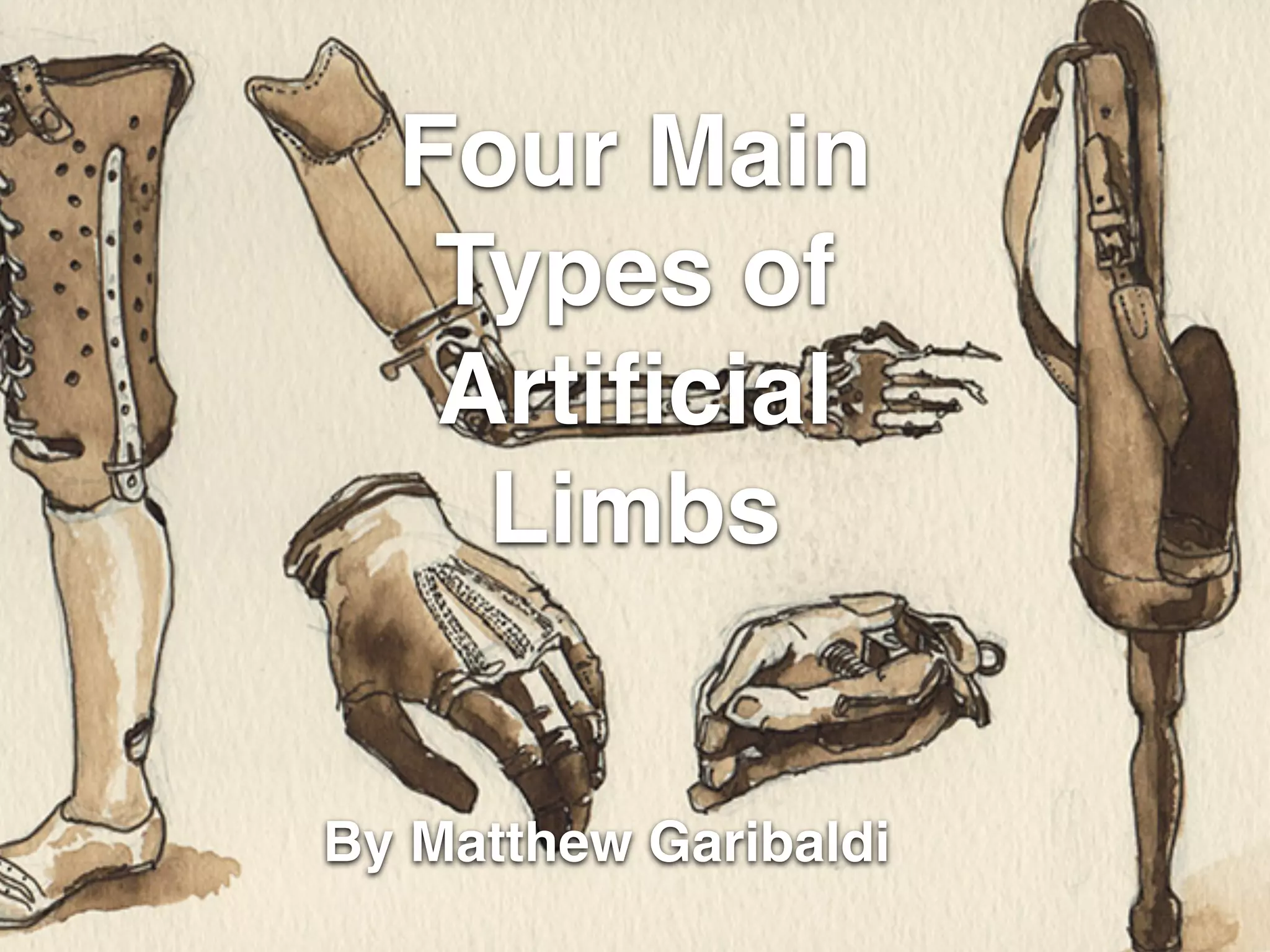 Four Main Types of Artificial Limbs, by Matthew Garibaldi | PPT