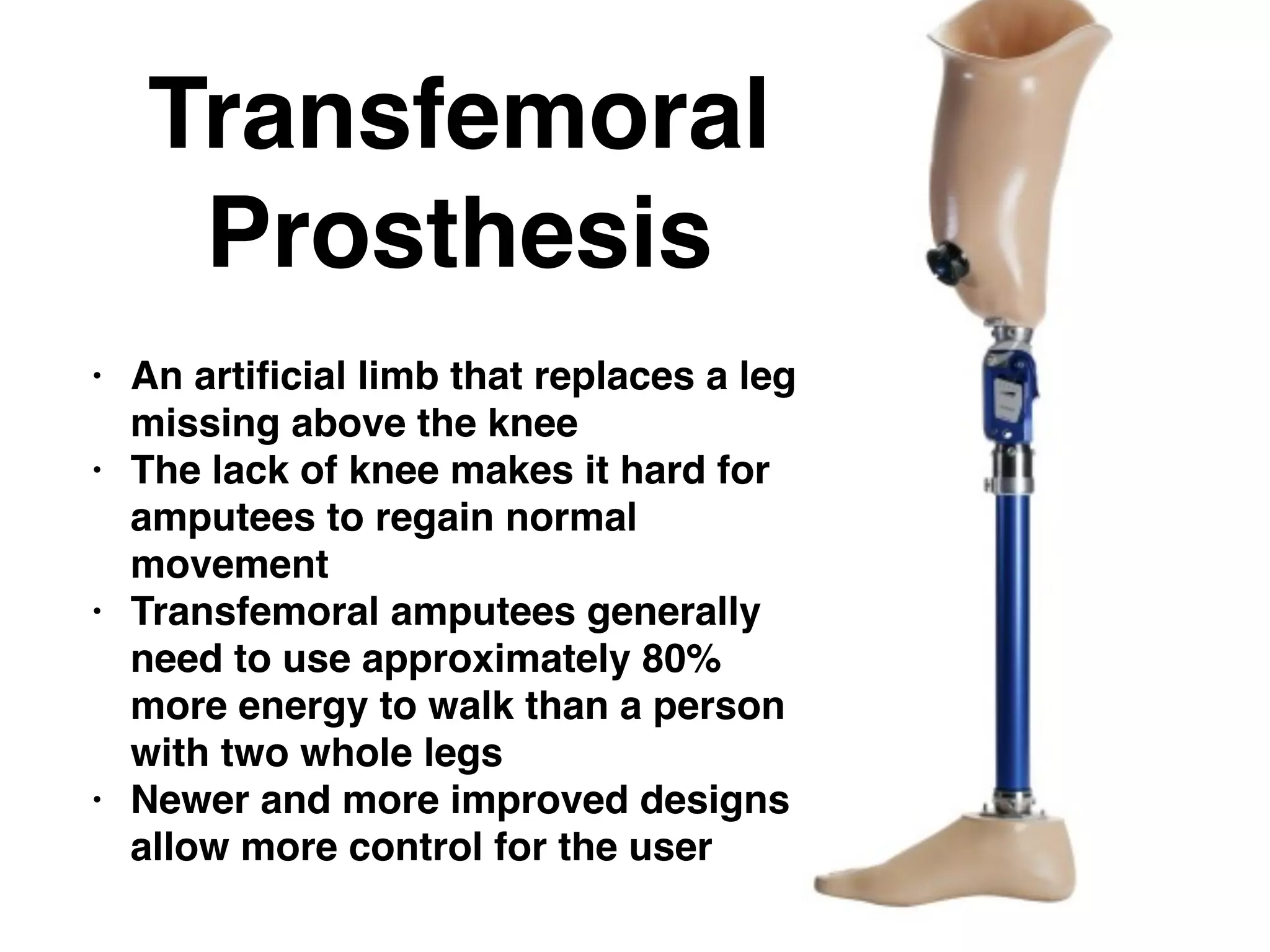 Four Main Types of Artificial Limbs, by Matthew Garibaldi | PPT