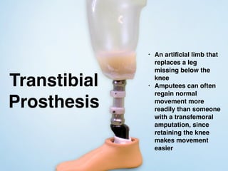 Four Main Types of Artificial Limbs, by Matthew Garibaldi | PPT