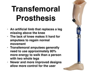Four Main Types of Artificial Limbs, by Matthew Garibaldi | PPT