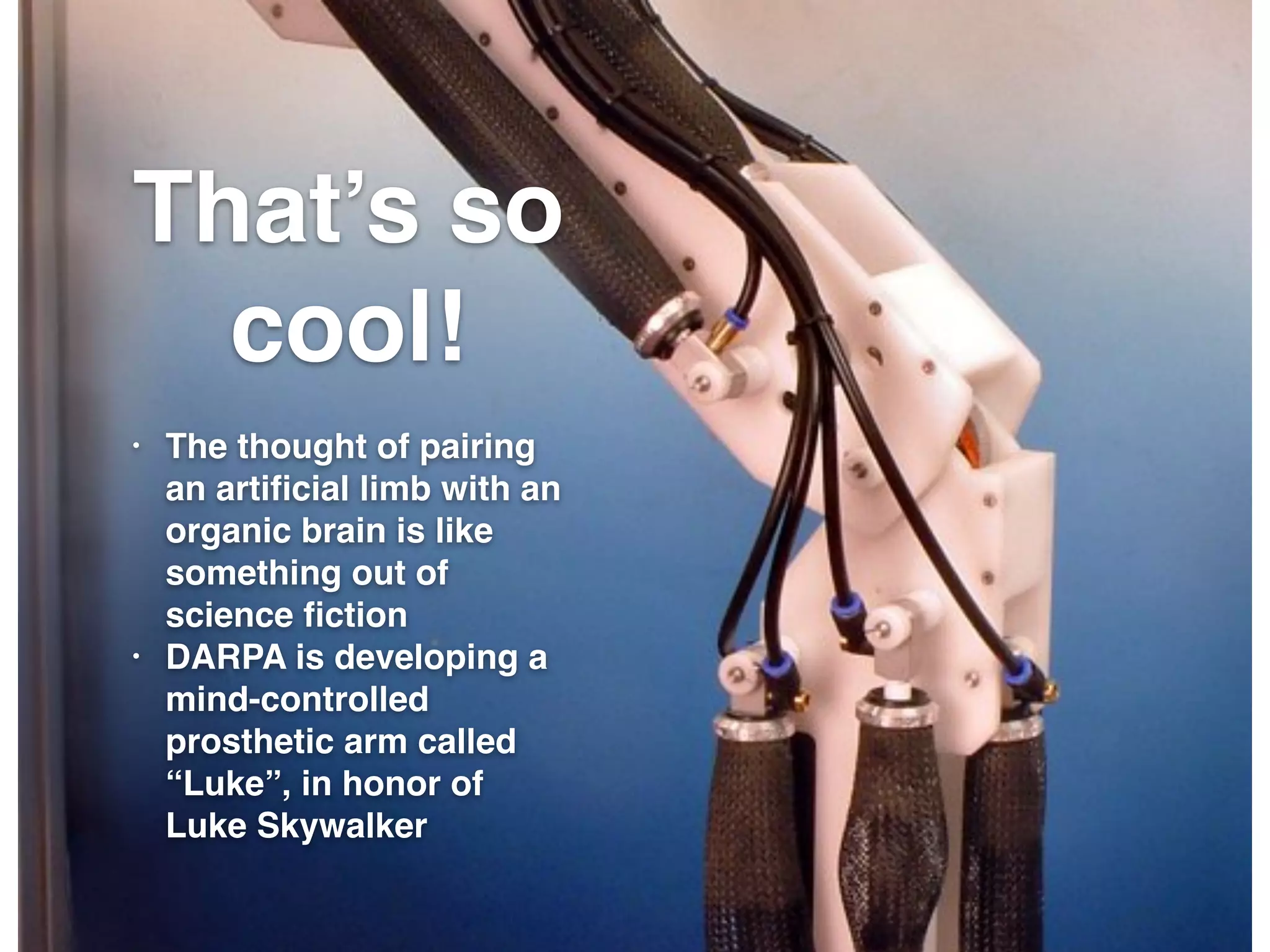 Mind-Controlled Prosthetics, by Matthew Garibaldi | PDF