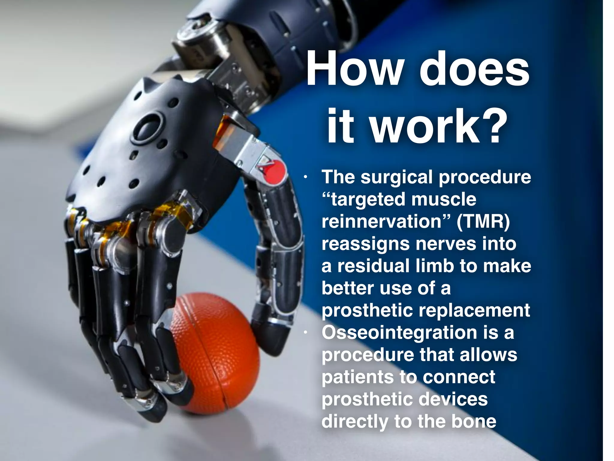 Mind-Controlled Prosthetics, by Matthew Garibaldi | PDF