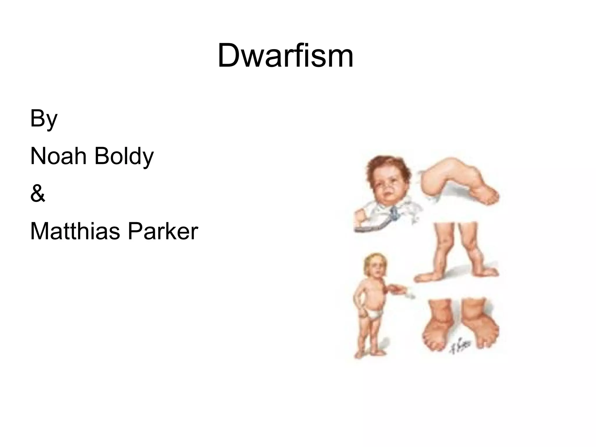 Matt & noah slideshow dwarfism | ODP