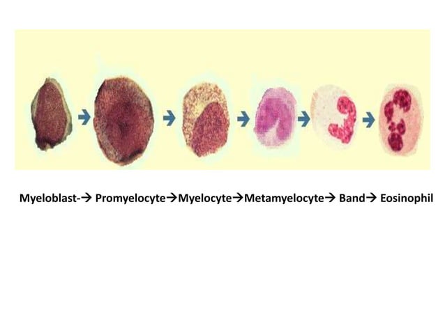 Maturation of eosinophil | PPTX | Blood Disorders | Diseases and Conditions