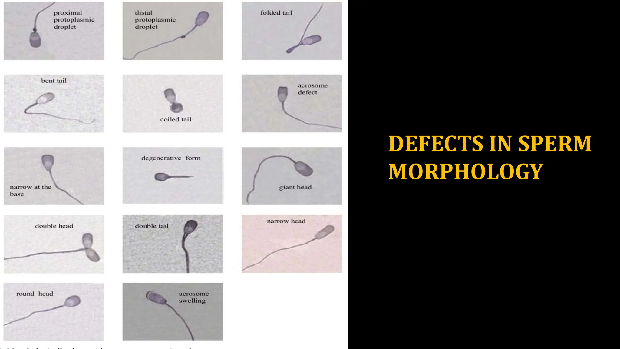 MATURE SPERM MORPHOLOGY AND SEMINAL PLASMA [Autosaved].pptx