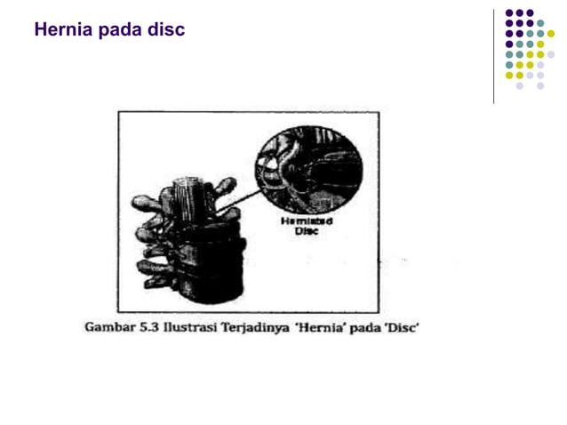petunjuk manual metode pengangkatan material | PPT