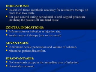 Maxillary Injection Technique | PPT