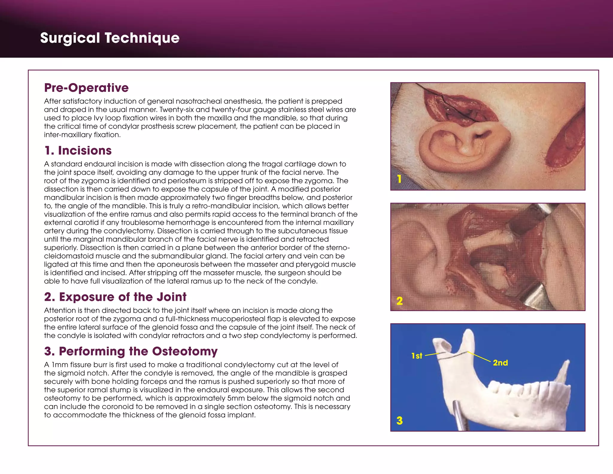 Maxilo Facial | PPT