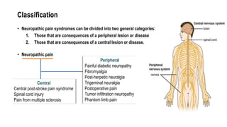 Management of neuropathic pain in combination | PPTX