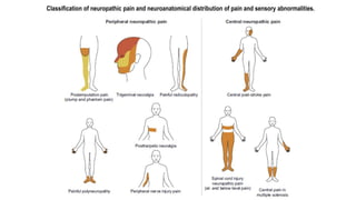 Management of neuropathic pain in combination | PPT