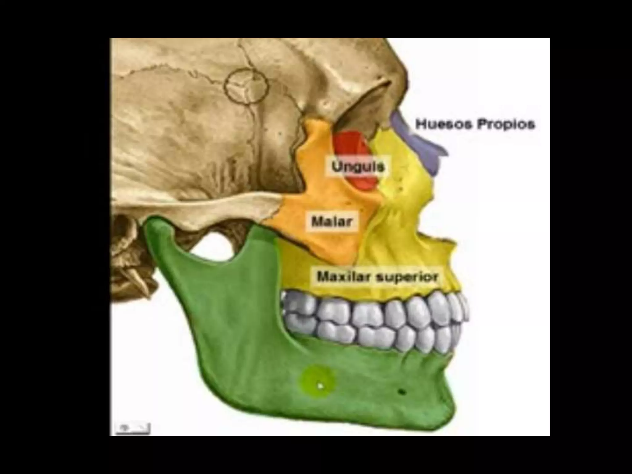 HUESO MAXILAR SUPERIOR