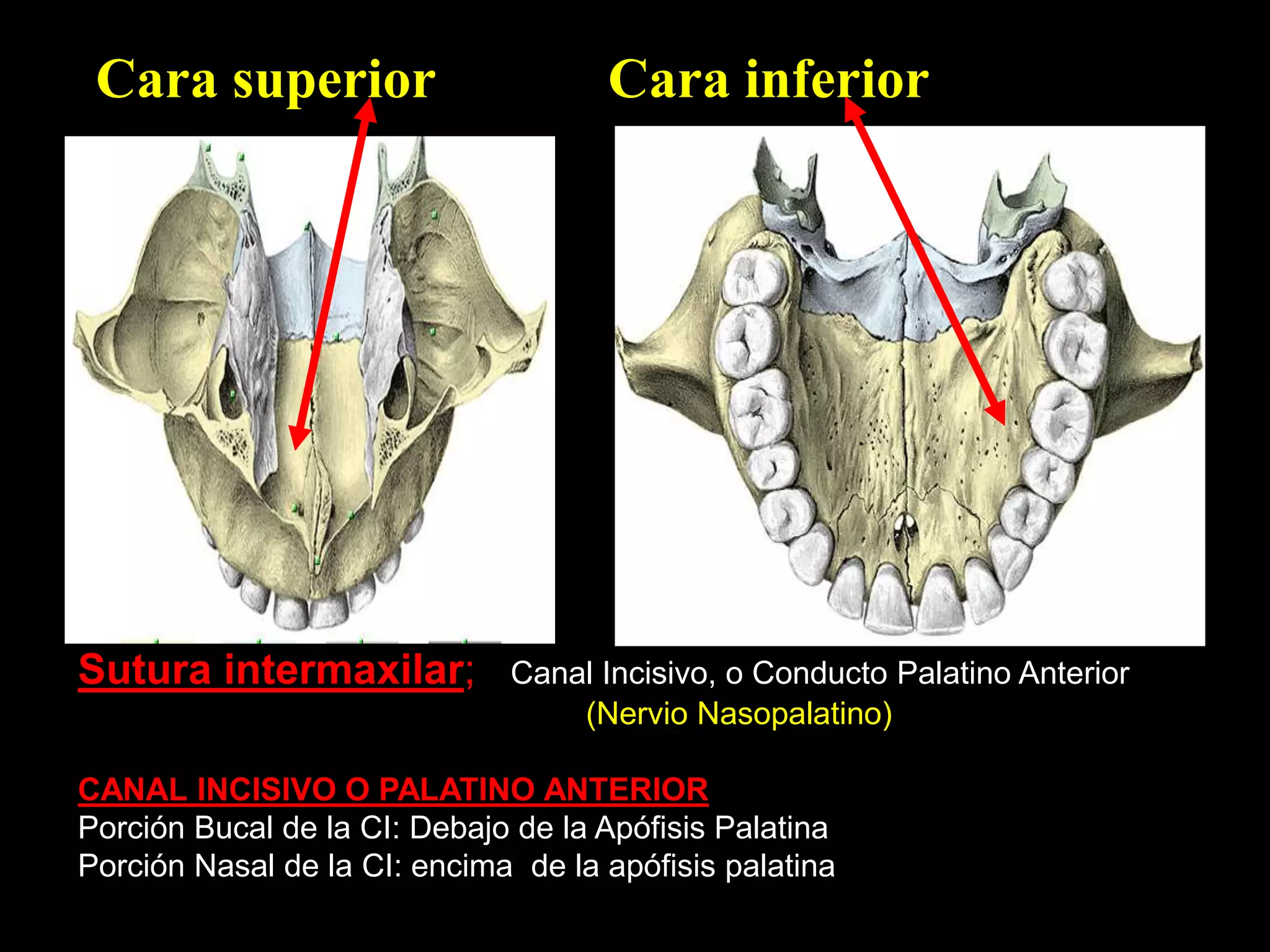 HUESO MAXILAR SUPERIOR
