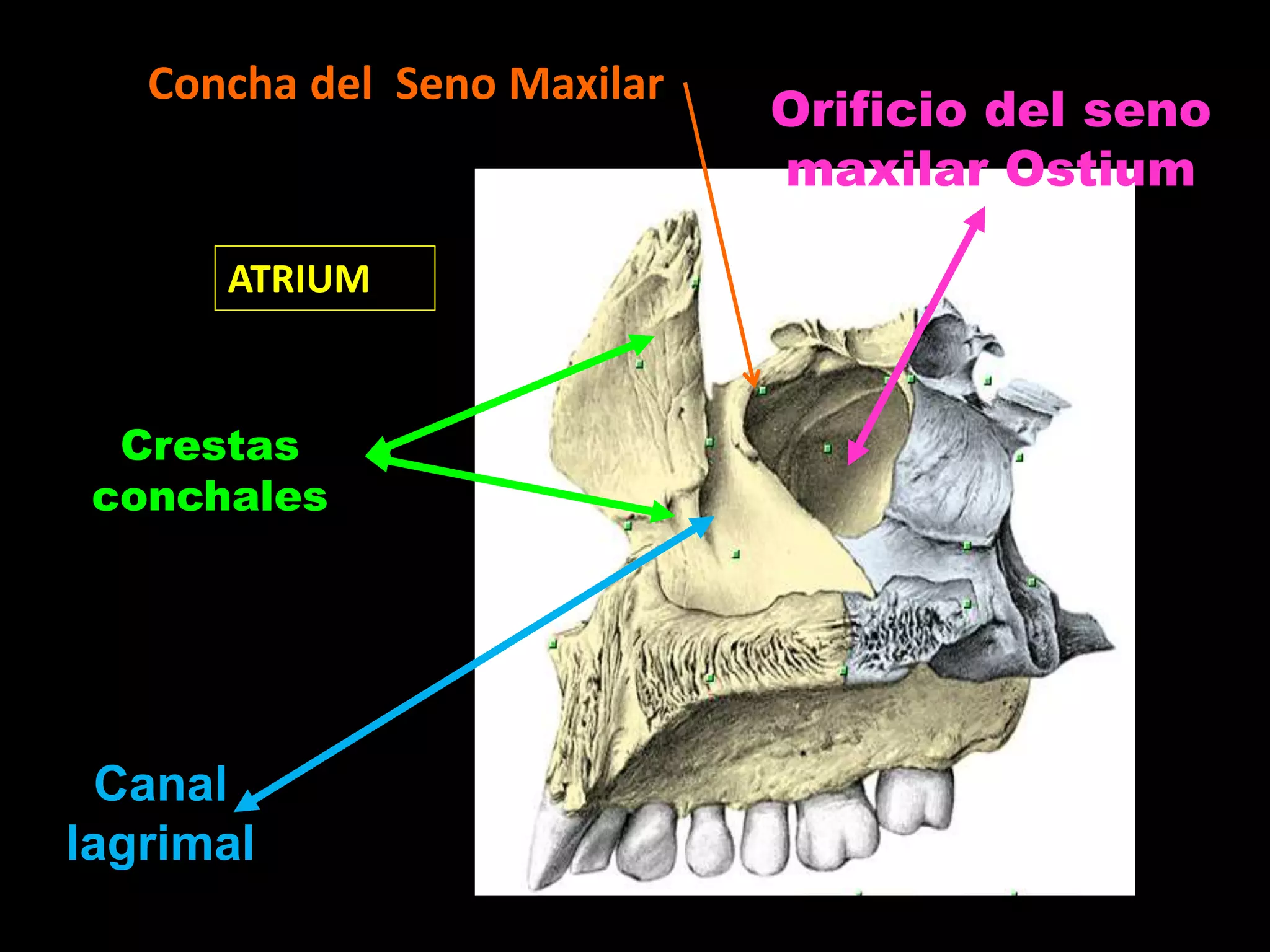 HUESO MAXILAR SUPERIOR