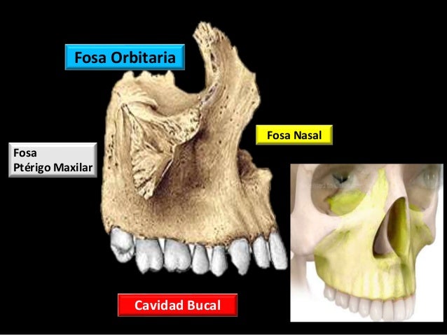 HUESO MAXILAR SUPERIOR