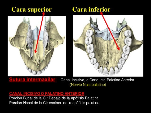 HUESO MAXILAR SUPERIOR