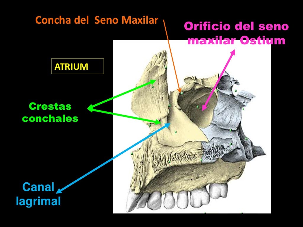 HUESO MAXILAR SUPERIOR