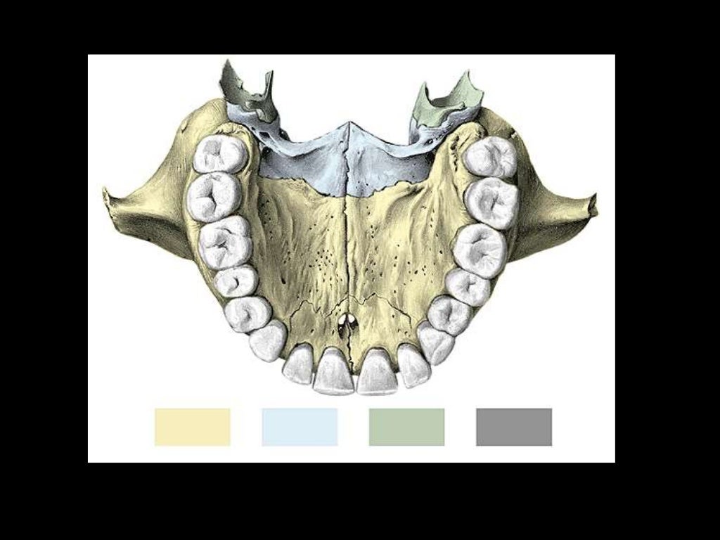 HUESO MAXILAR SUPERIOR