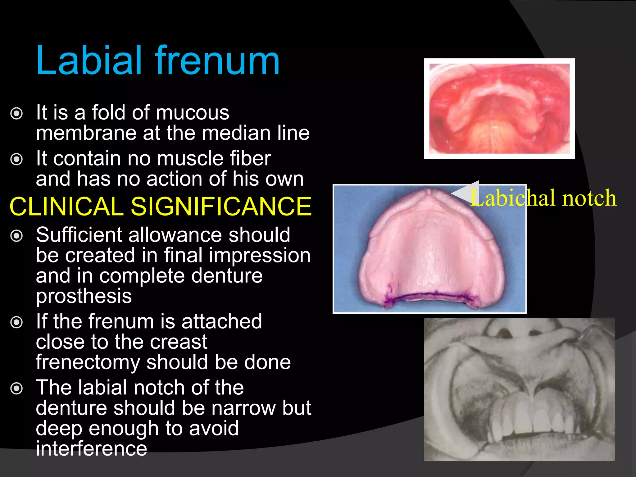 significance of maxillary denture bearing area | PPTX