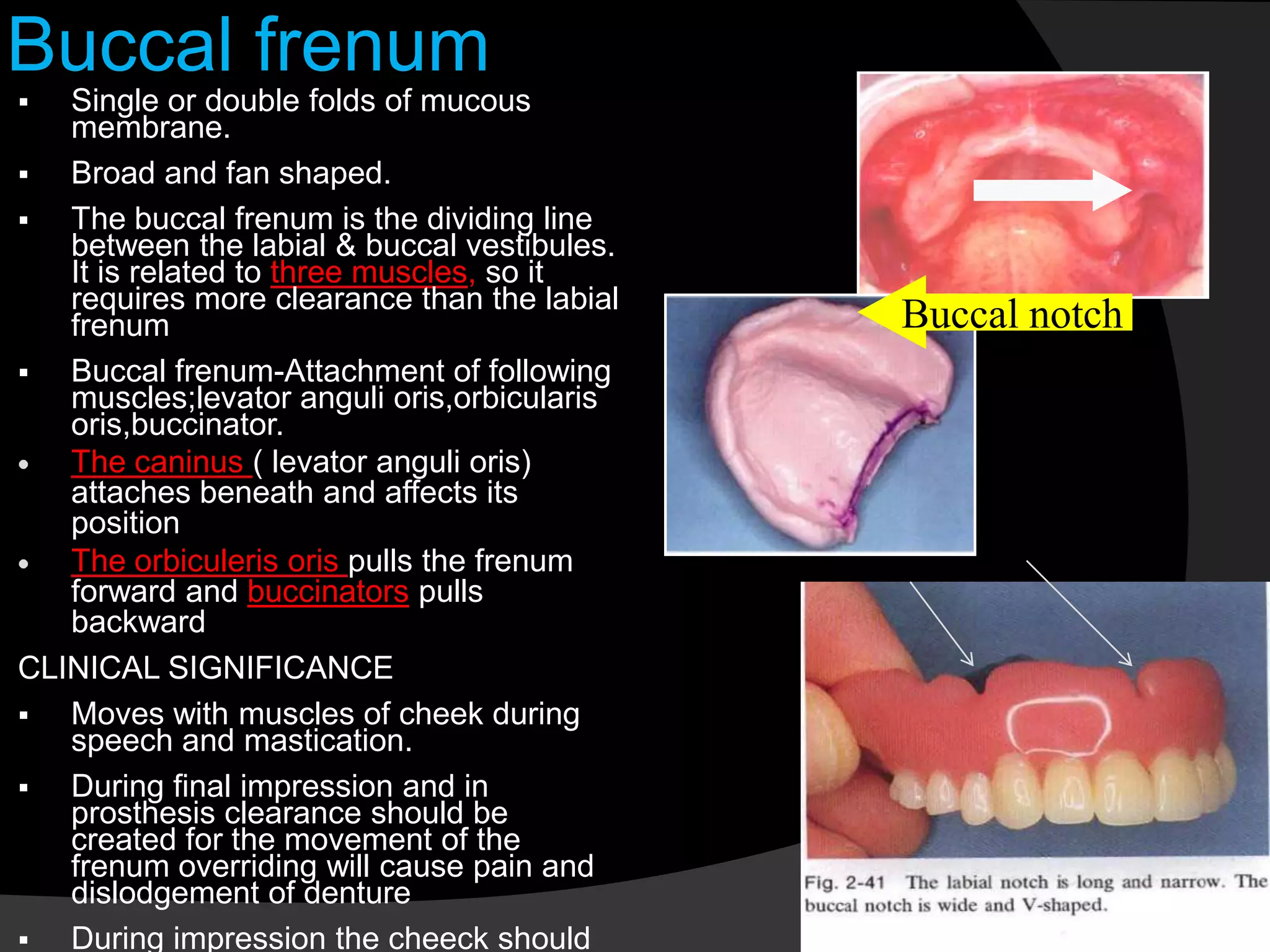significance of maxillary denture bearing area | PPTX