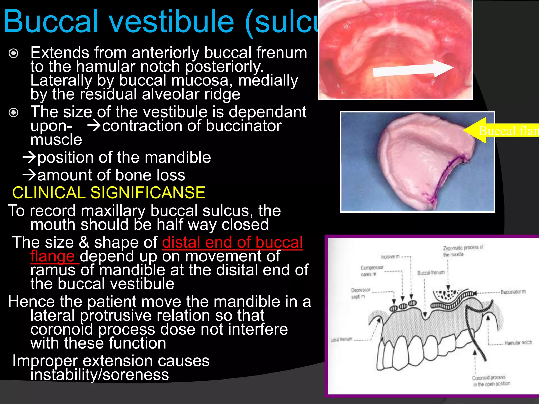 significance of maxillary denture bearing area | PPTX
