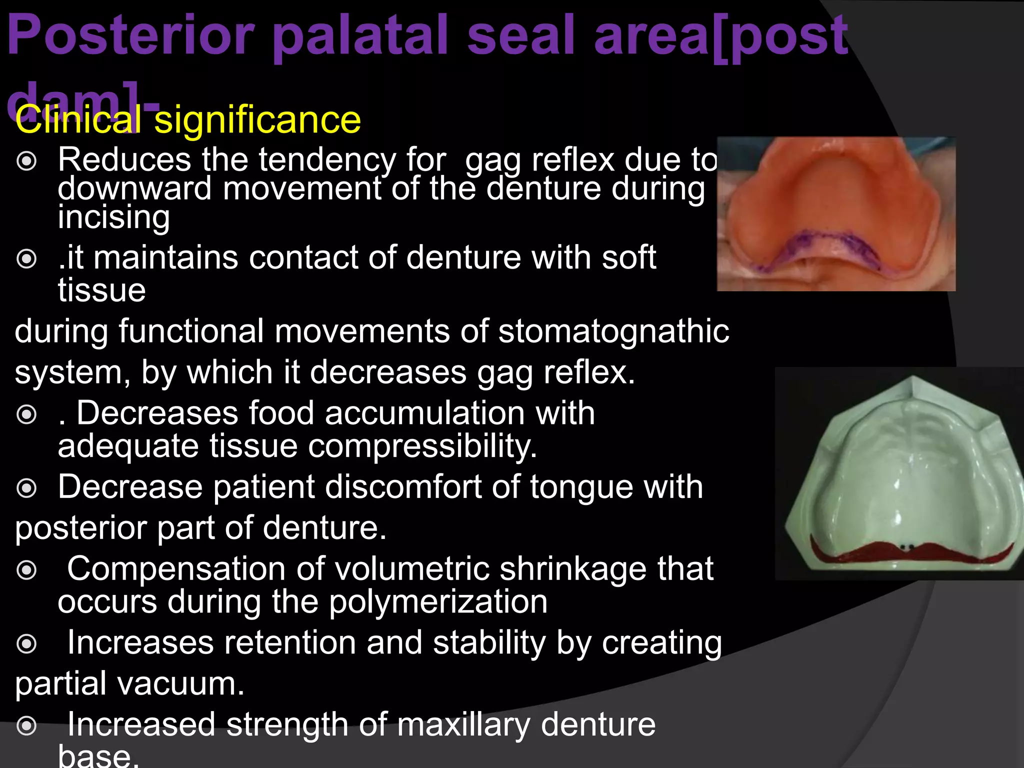 significance of maxillary denture bearing area | PPTX