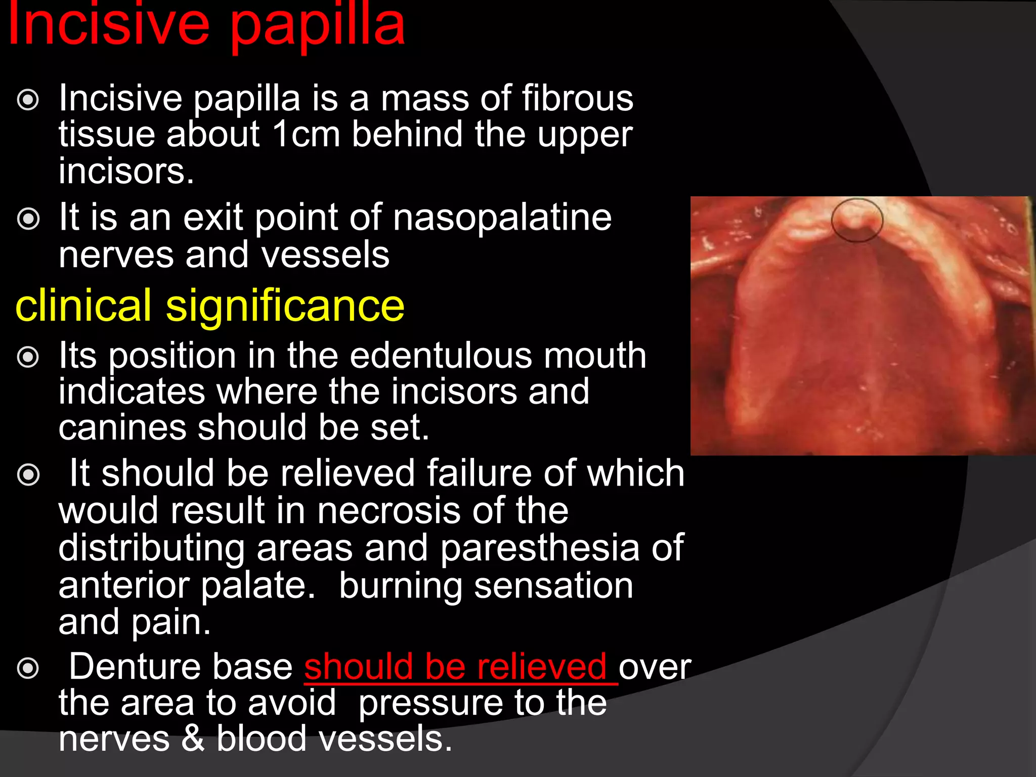 significance of maxillary denture bearing area | PPTX