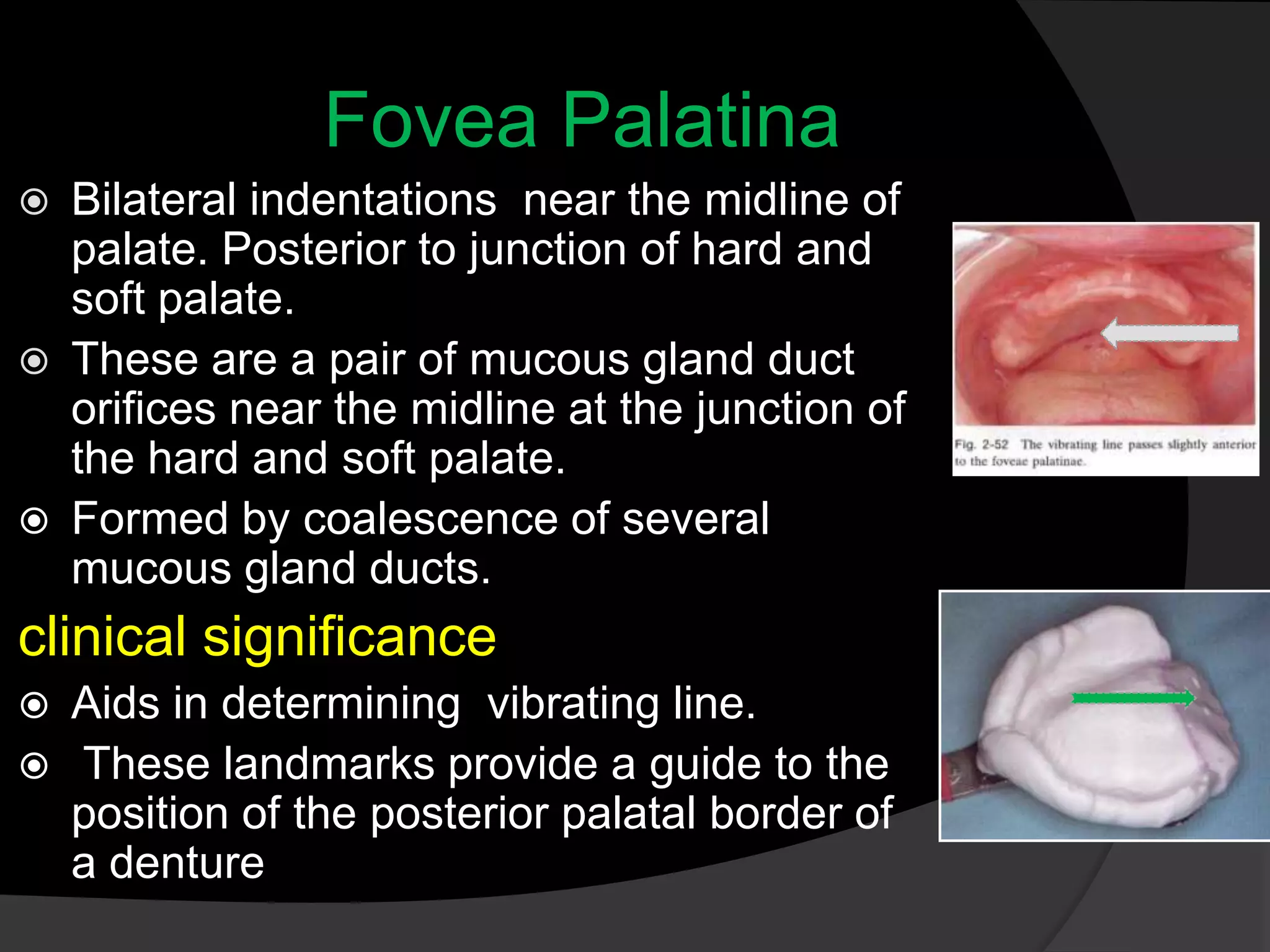 significance of maxillary denture bearing area | PPTX