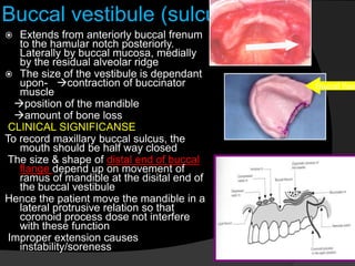 significance of maxillary denture bearing area | PPTX