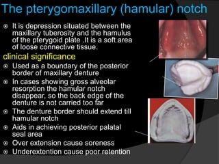 significance of maxillary denture bearing area | PPTX