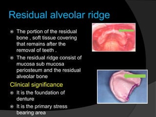 significance of maxillary denture bearing area | PPTX