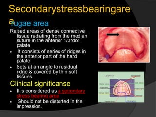 significance of maxillary denture bearing area | PPTX
