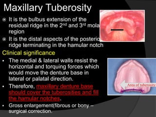 significance of maxillary denture bearing area | PPTX