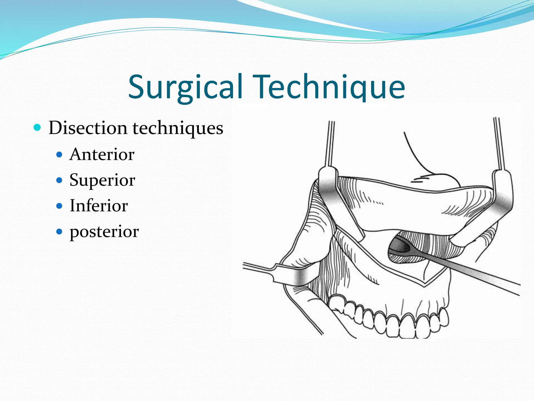 Maxillary surgery | PPT