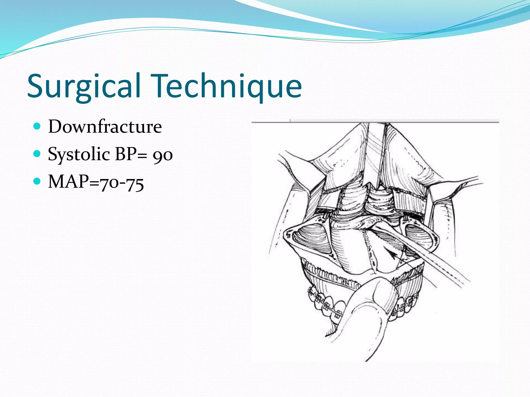 Maxillary surgery | PPT