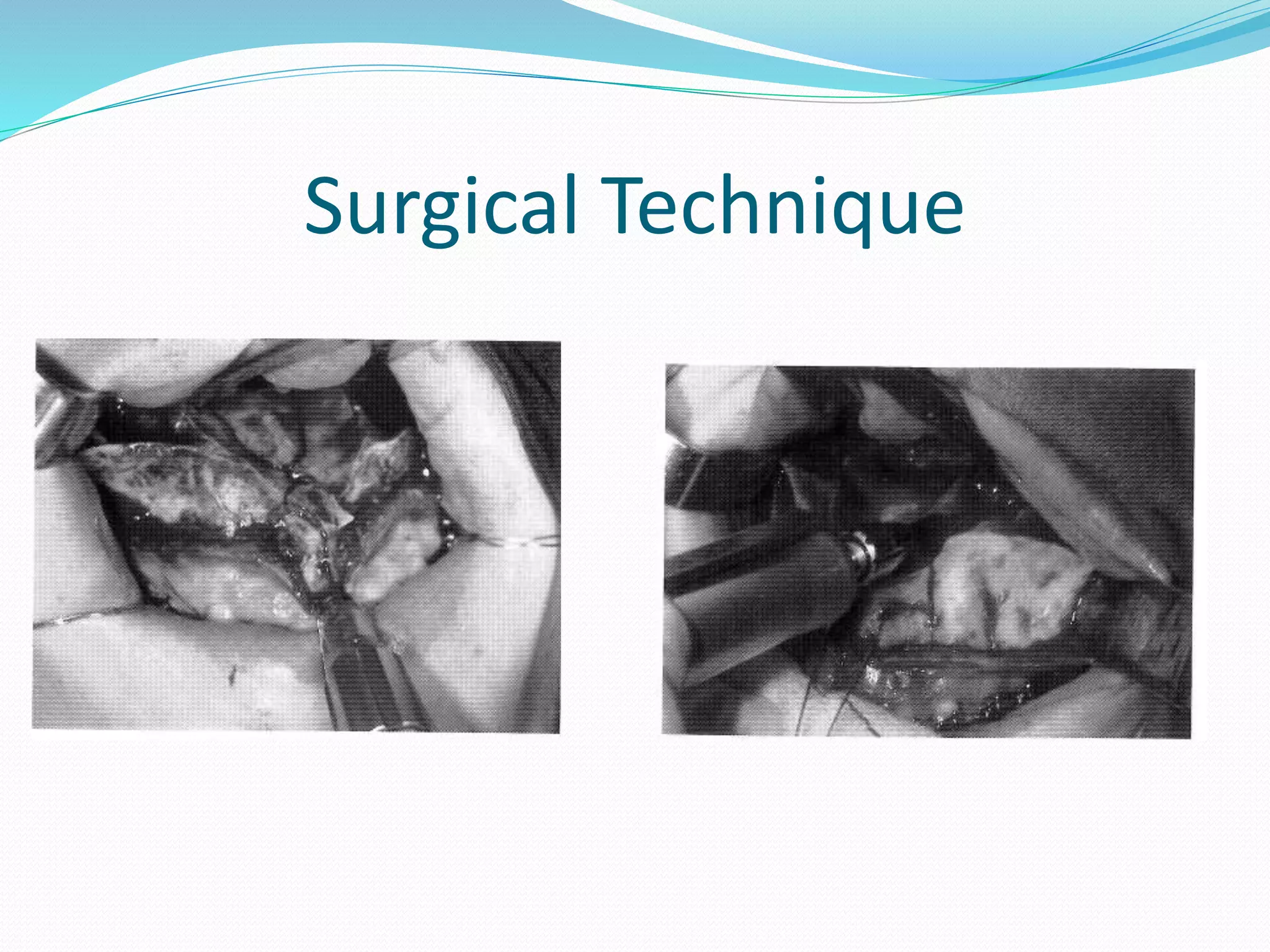 Maxillary surgery | PPT