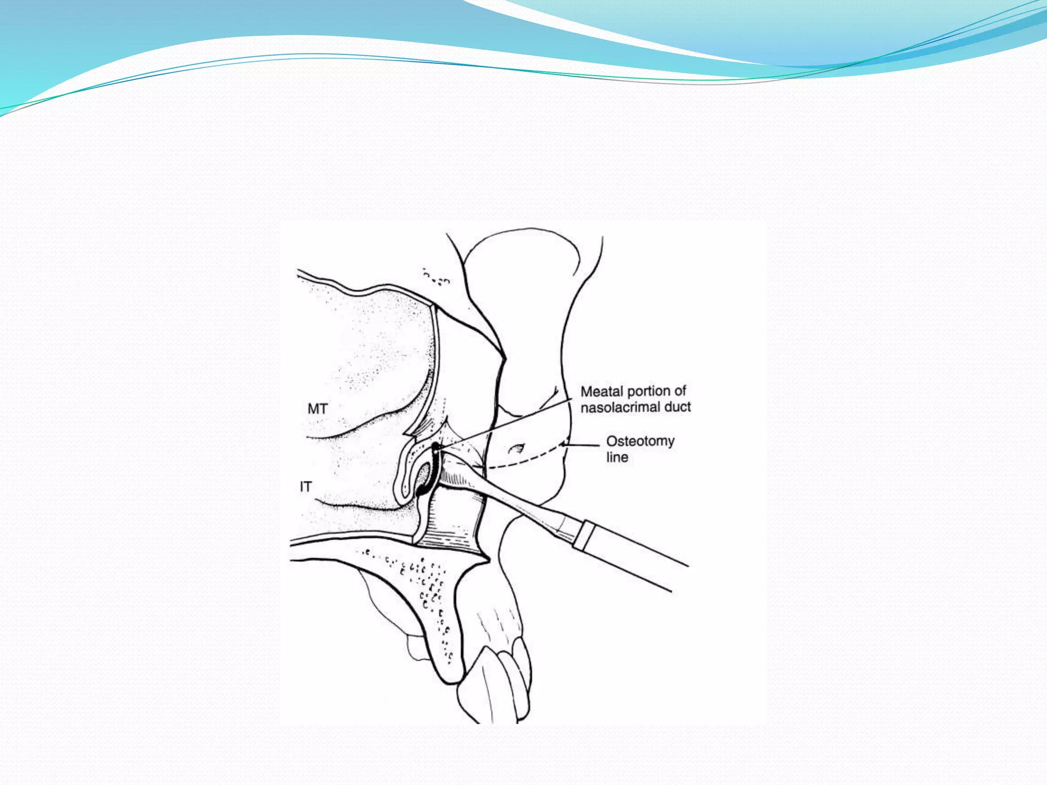 Maxillary surgery | PPT