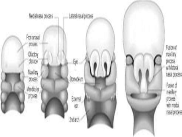 Development,anatomy and applied anatomy of Maxilla | PPTX
