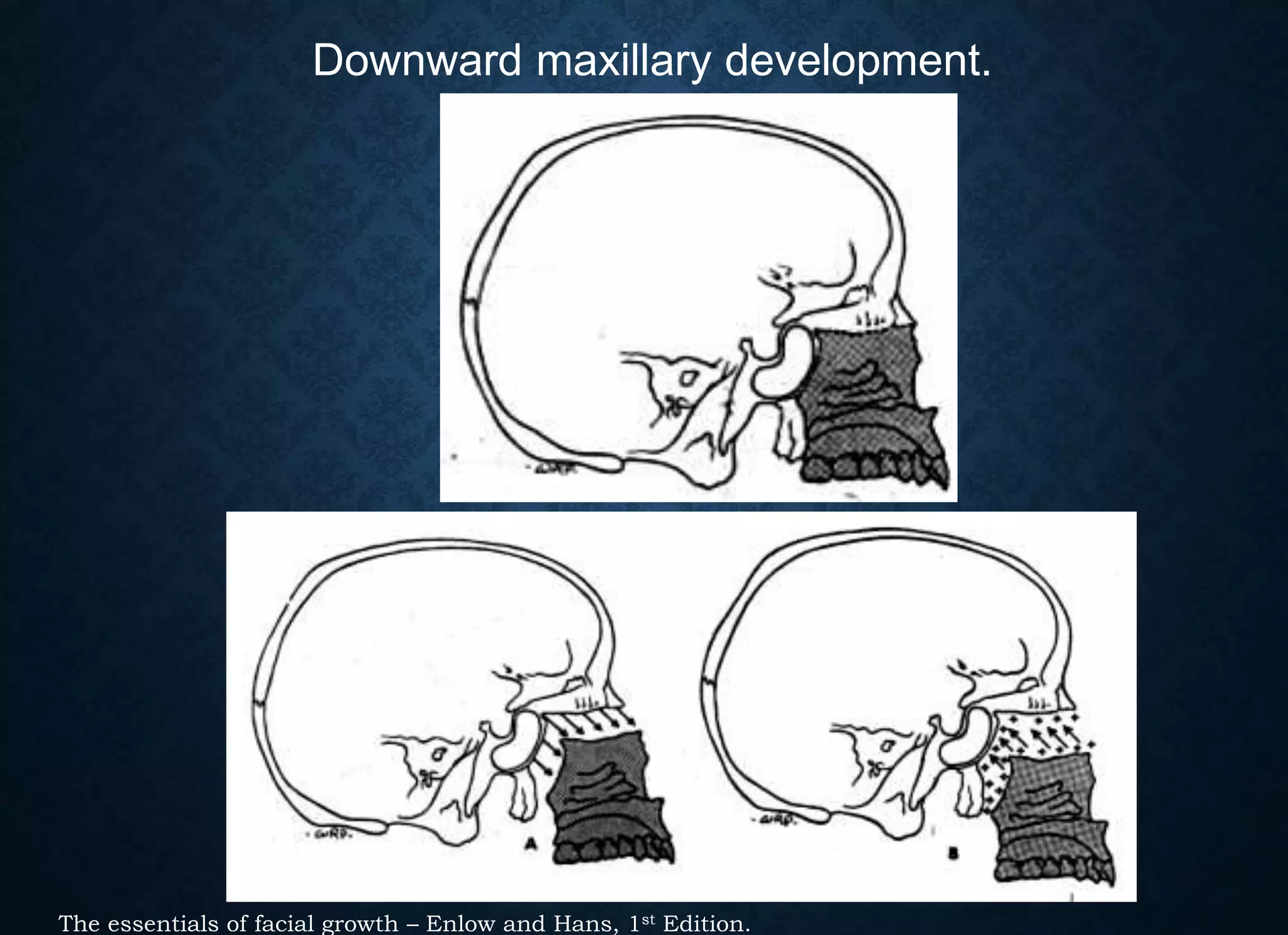 Maxilla | PPTX