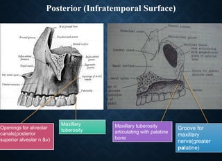 Maxilla | PPTX