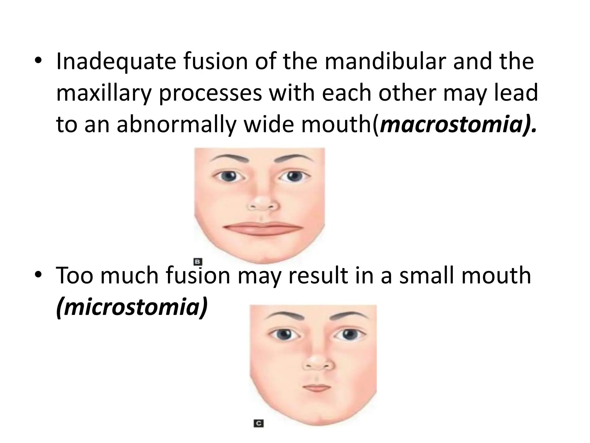 maxilla, development and clinical corelation.pptx