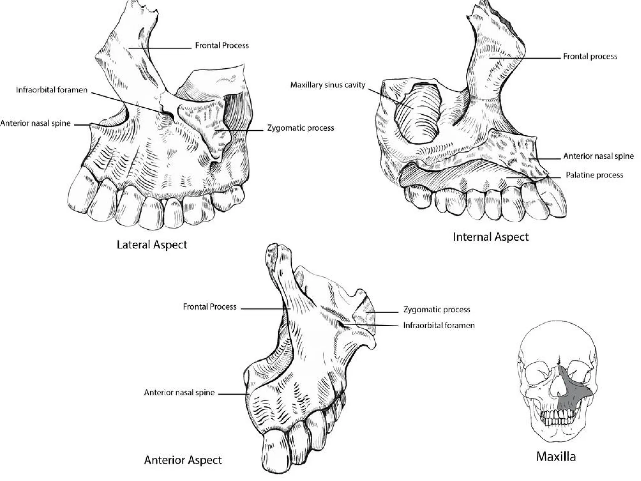 ANATOMY OF MAXILLA WITH CLINICAL CORRELATIONS | PPTX