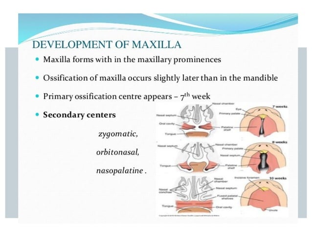 ANATOMY OF MAXILLA WITH CLINICAL CORRELATIONS | PPTX
