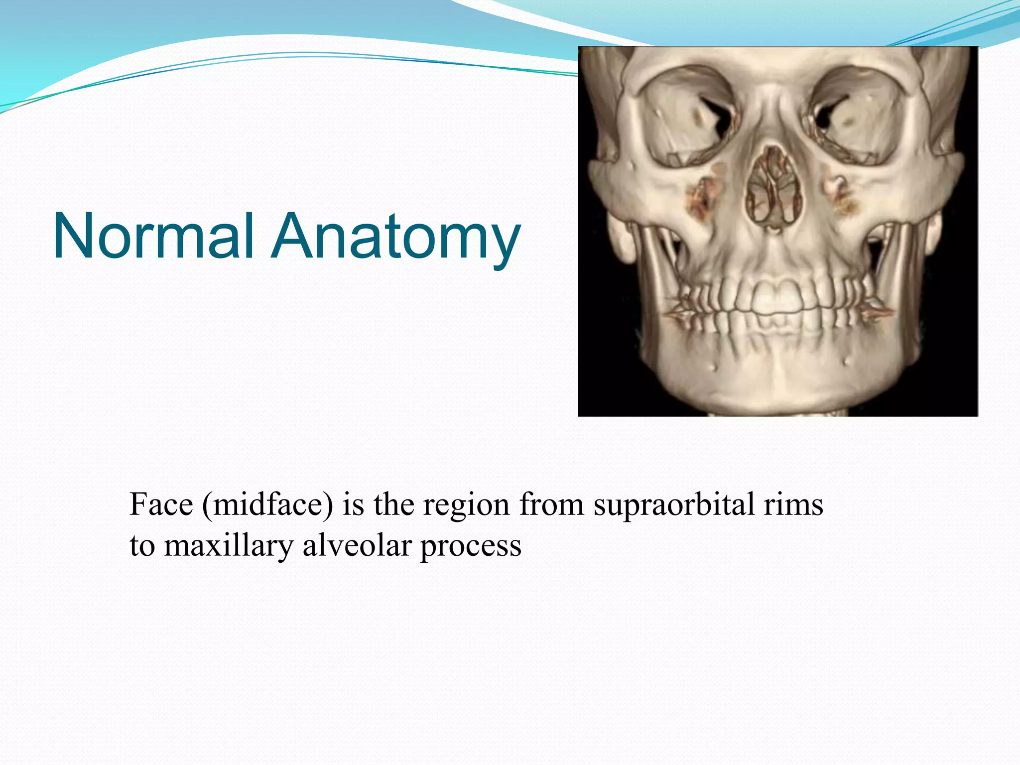 Maxilla anatomy, development & surgical anatomy | PPTX