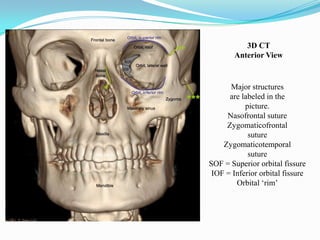 Maxilla anatomy, development & surgical anatomy | PPTX