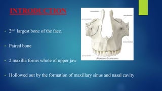 Maxilla basics and applied anatomy DR RAJIV.pptx