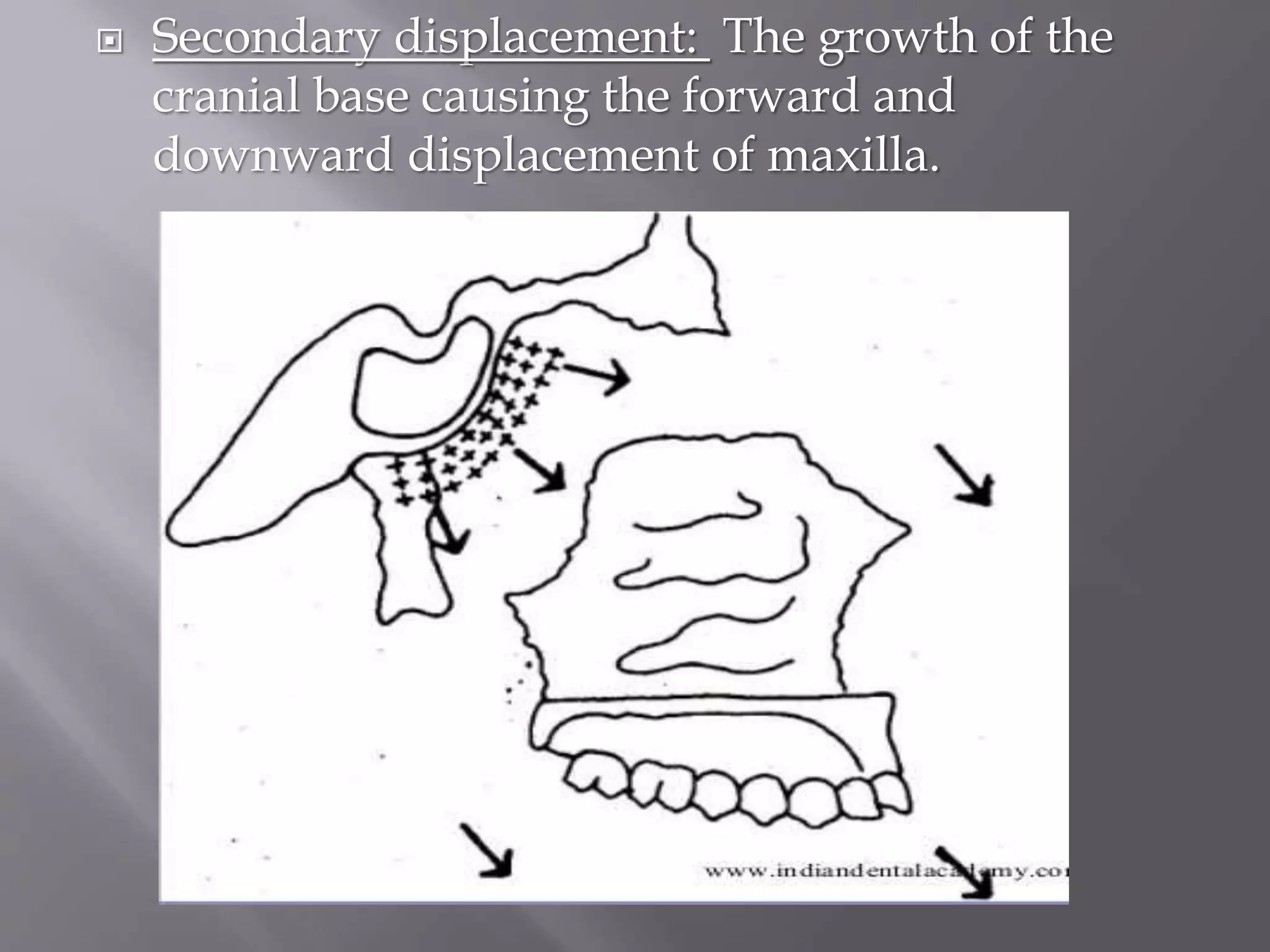 Maxilla and Mandible | PPTX