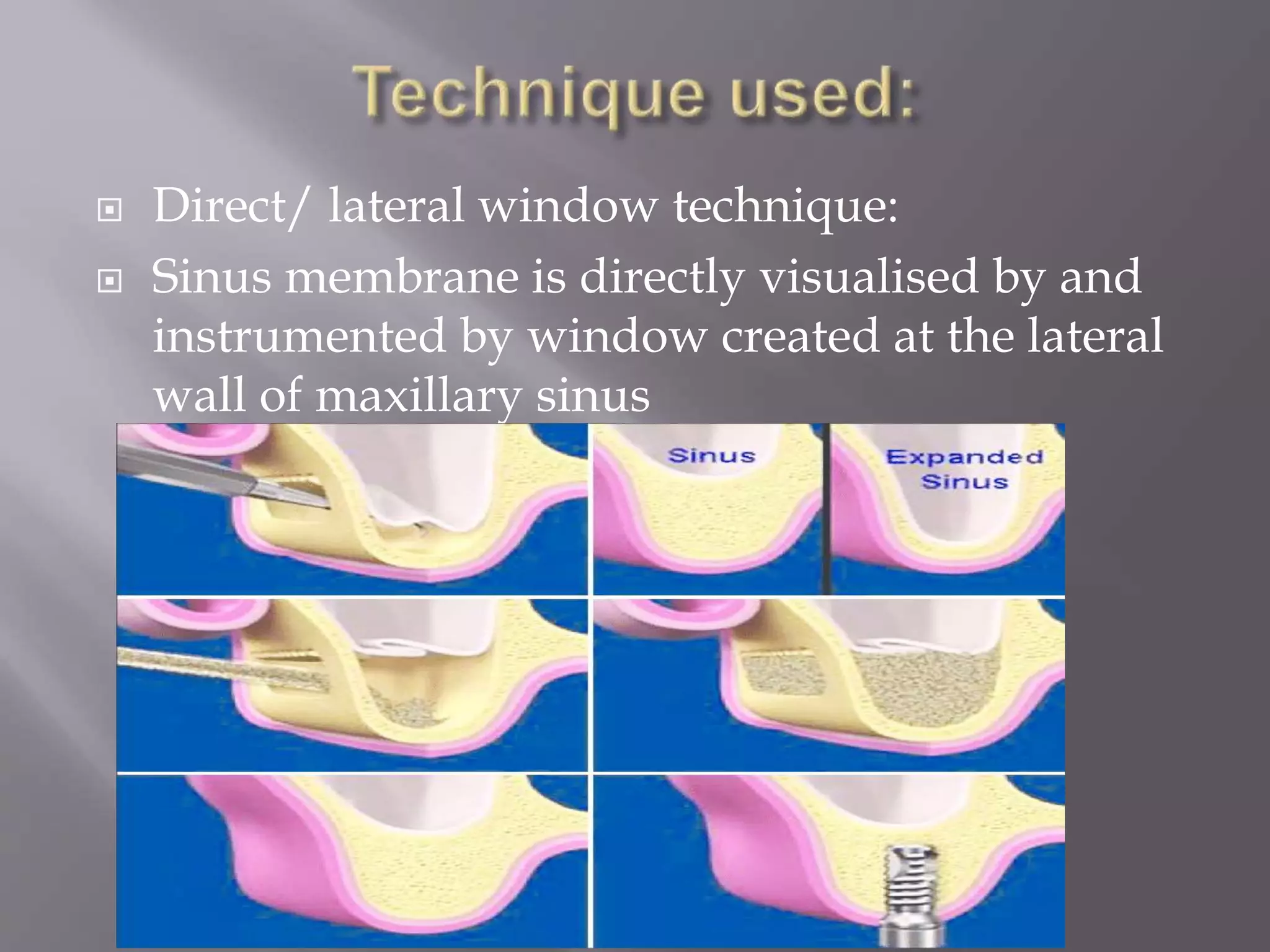 Maxilla and Mandible | PPTX