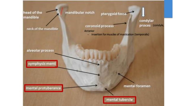Maxilla, Mandible & Hyoid Bone by Dr. RIG.pptx